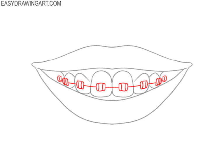How to Draw Braces - Easy Drawing Art