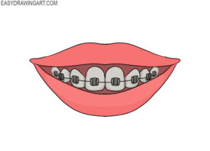 How to Draw Braces - Easy Drawing Art